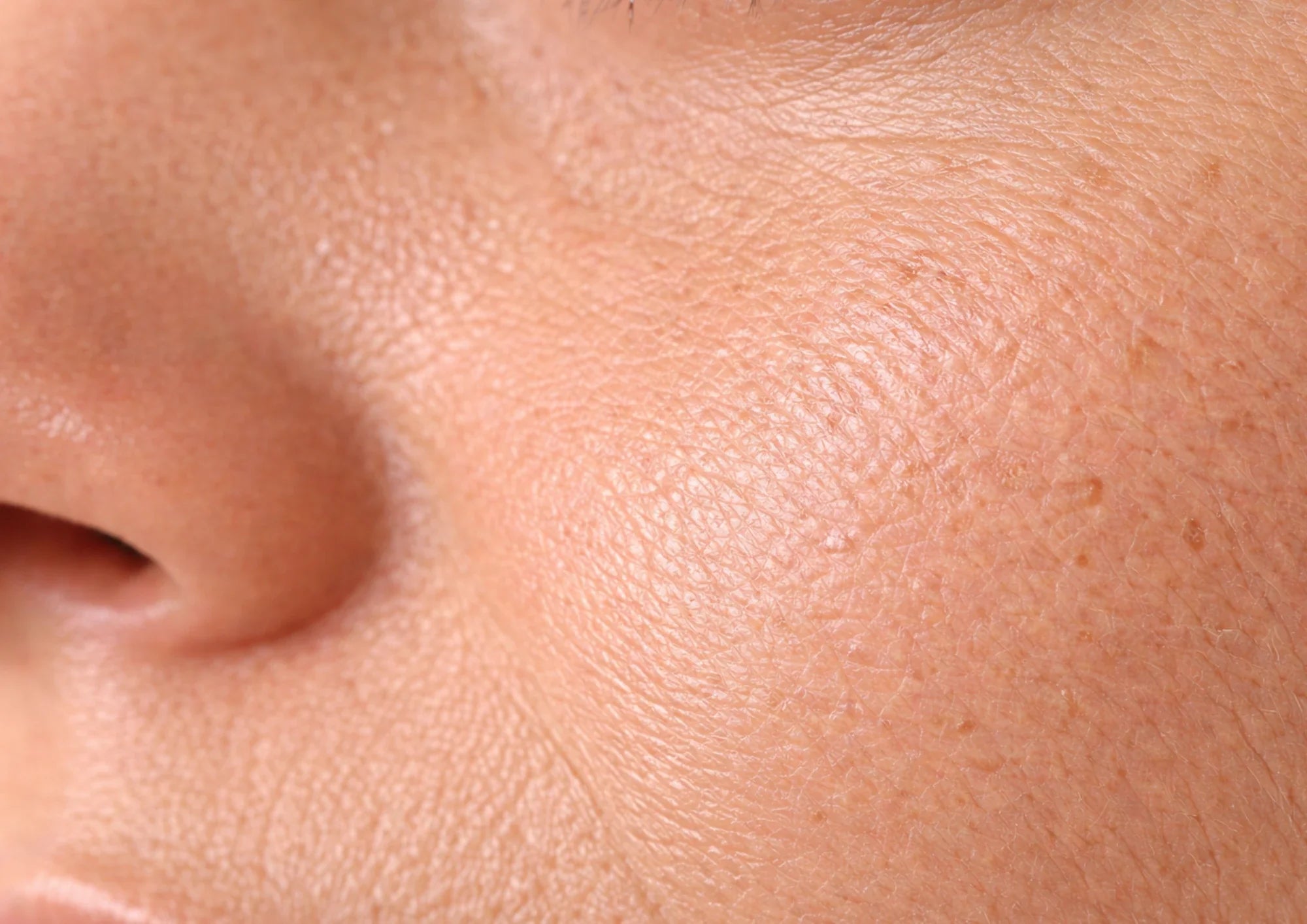 Huid met tekenen van veroudering – Nouvital Cosmetics